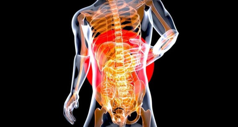 Peritonitis - Qué es, definición y concepto