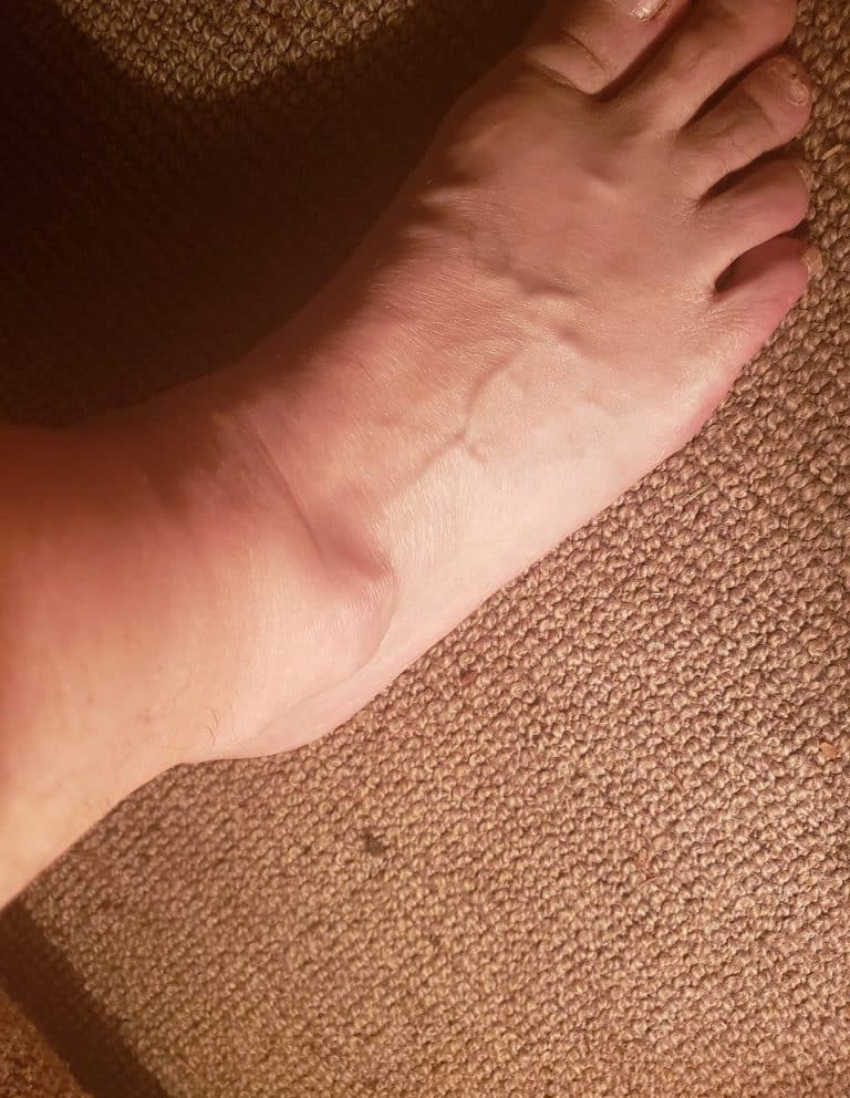 Protuberancia - Qué es, definición y concepto