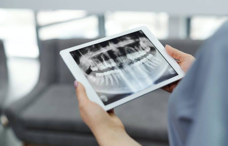 Prognatismo - Qué es, características, causas, consecuencias e historia