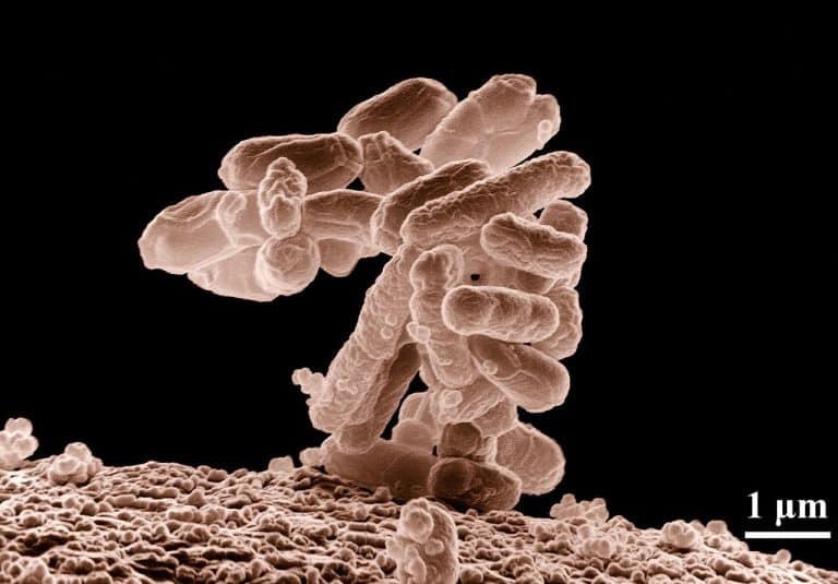 Pulmonía - Qué es, tipos, definición y concepto