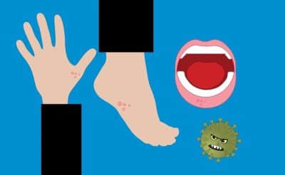 Prurito - Qué es, causas, definición y concepto