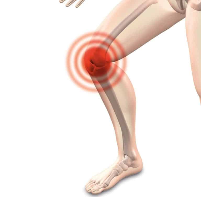 Rodilla - Qué es, definición y concepto